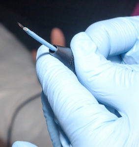 La chirurgie gynécologique - Gynelac Annecy - Tumeurs et cancers